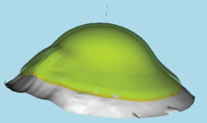 EyePrintPro – EyePrint Prosthetics