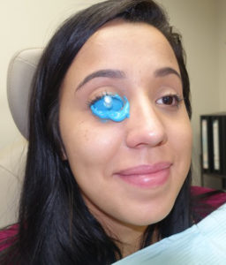 Process – EyePrint Prosthetics