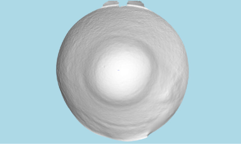 EyeFitPro – EyePrint Prosthetics