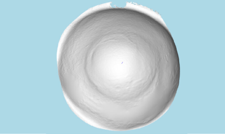 EyeFitPro – EyePrint Prosthetics